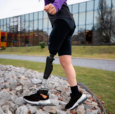 Axiles Bionics : Revolutionizing Prosthetic Feet