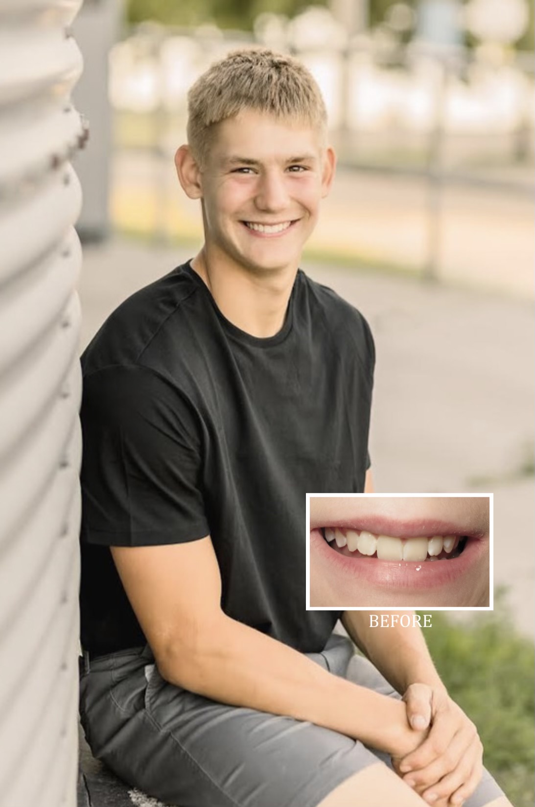 Patient Before & Afters | 320 Dental Studio