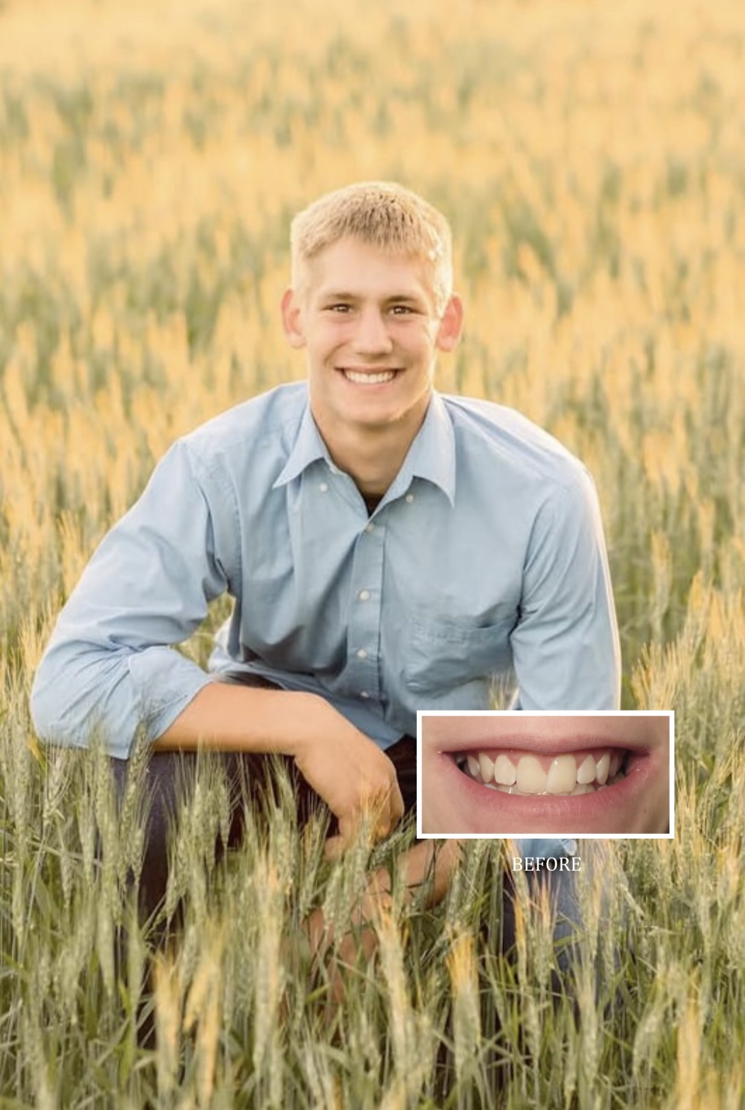 Patient Before & Afters | 320 Dental Studio