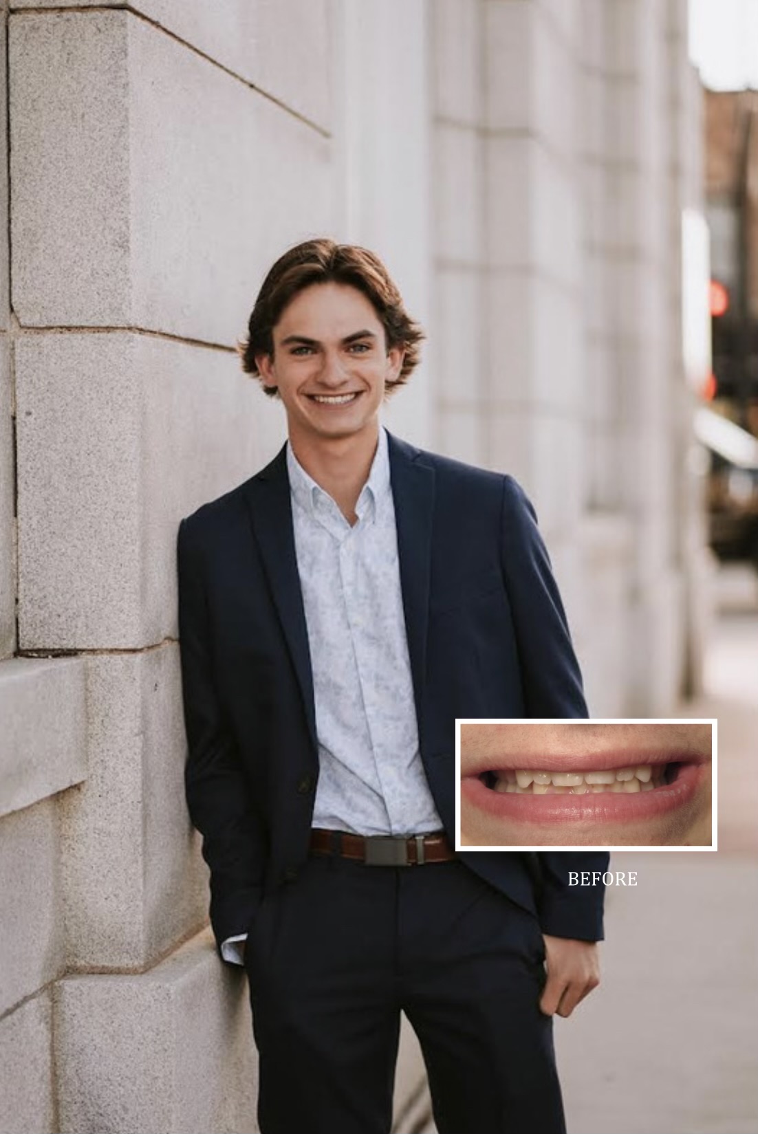 Patient Before & Afters | 320 Dental Studio