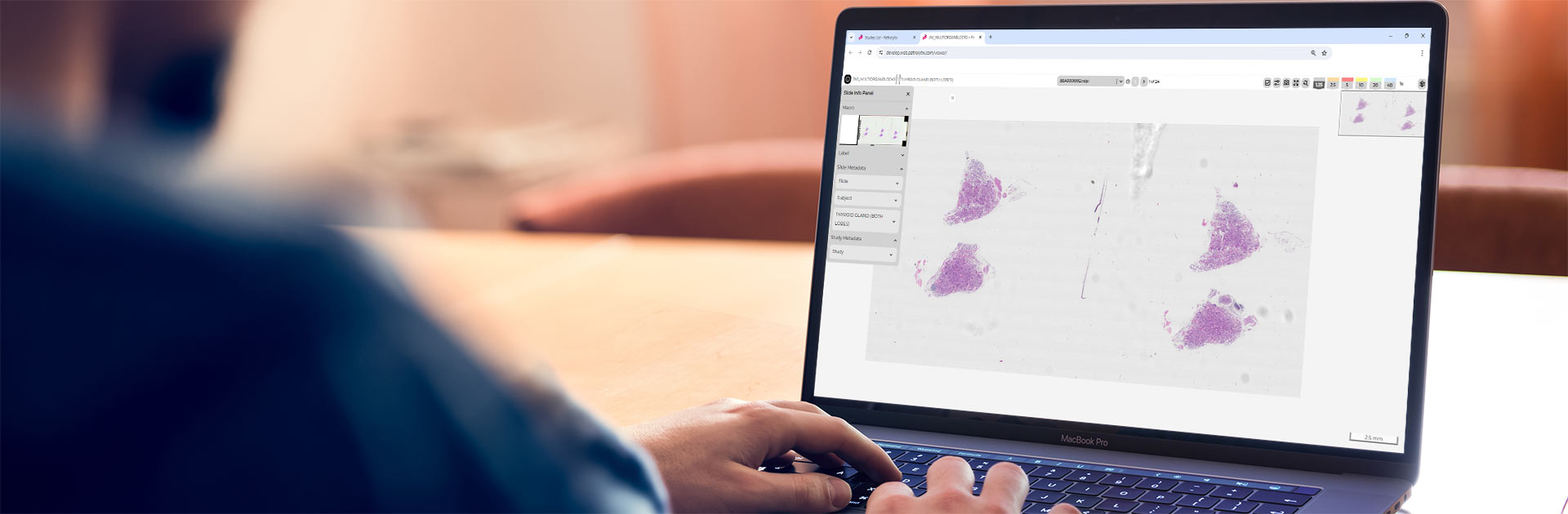 Deciphex - Accelerating Certainty