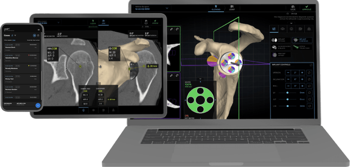 Arthrex Arthroplasty