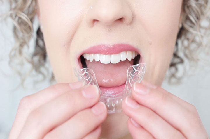 The AAA offer - Billingshurst Dental Practice | Dentist West Sussex