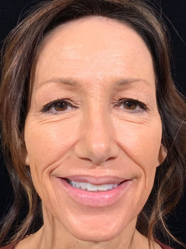 Treatments for Hollow Temples