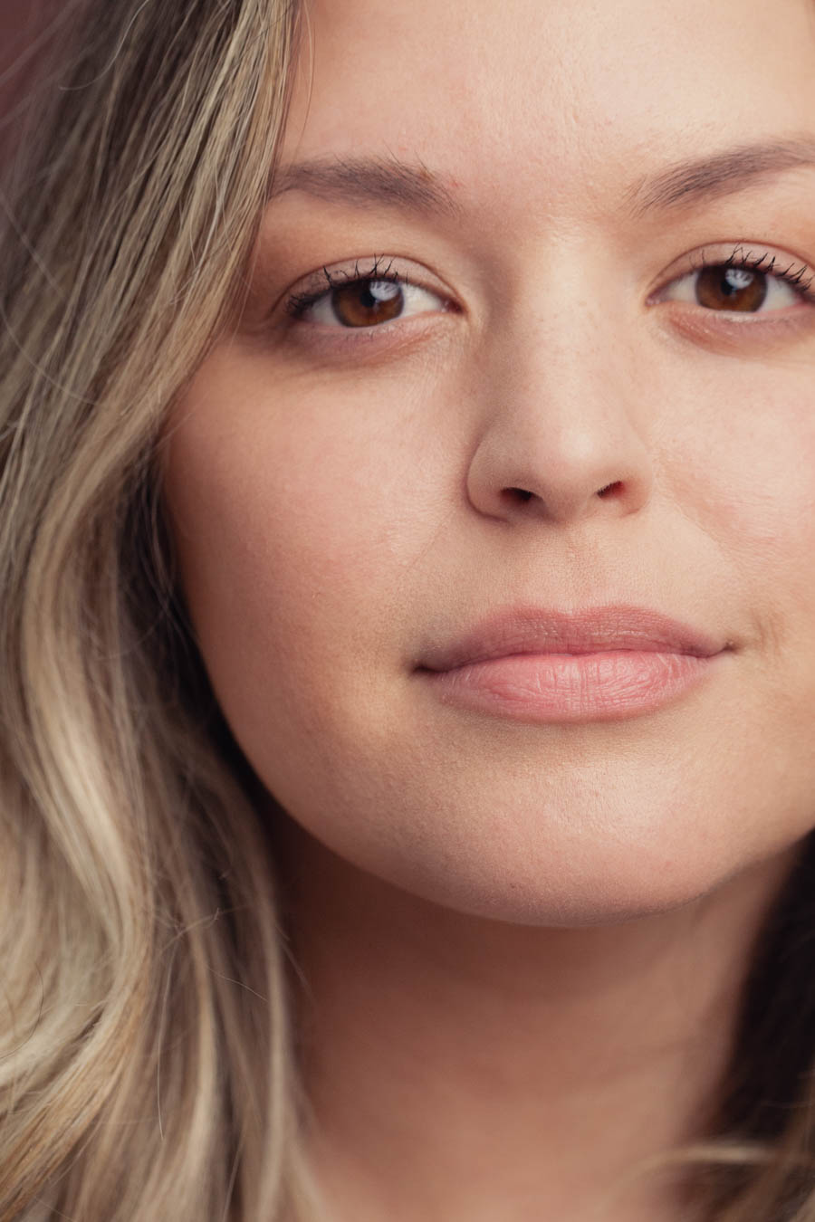 Midface Filler in El Dorado Hills | Esthetics Center