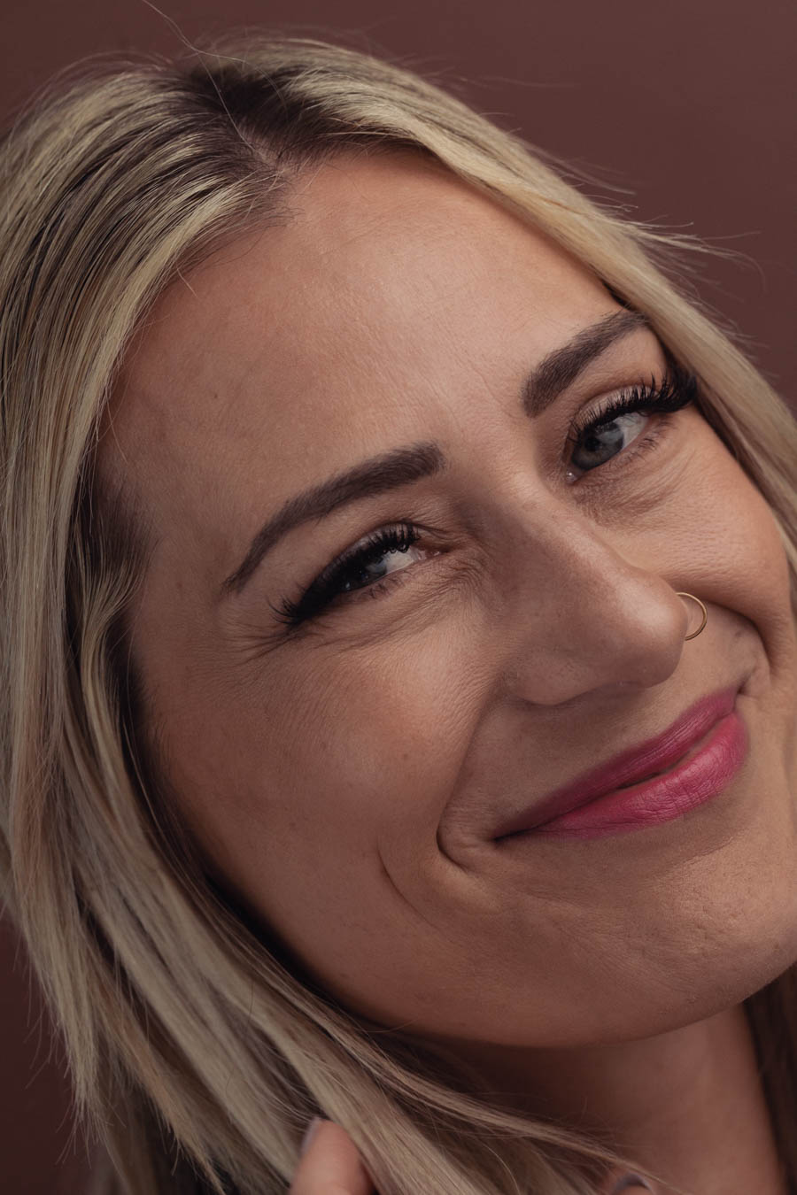 Upperface Filler in El Dorado Hills | Esthetics Center