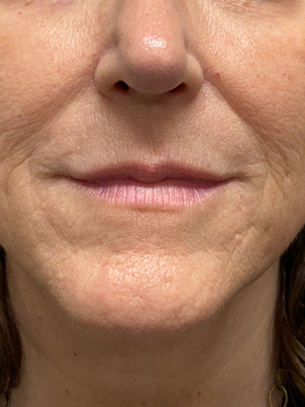 Esthetics Center: Cosmetic Surgery and Med Spa