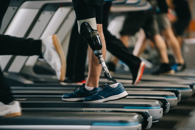 Above Knee Prosthetic Leg in New Mexico | PrimeCare Orthotics & Prosthetics