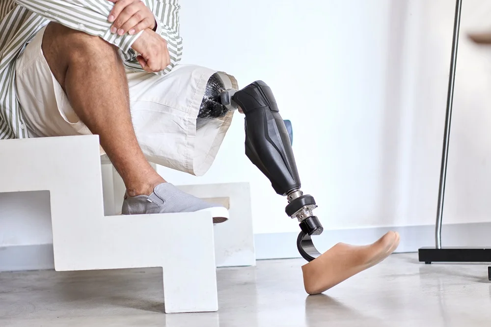 K-Levels for Prosthetics: Assessing Rehabilitation Potential