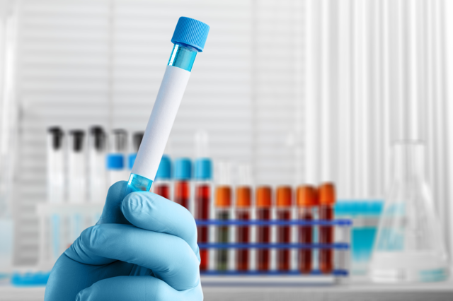 Mizu App — What exactly is the ACR?