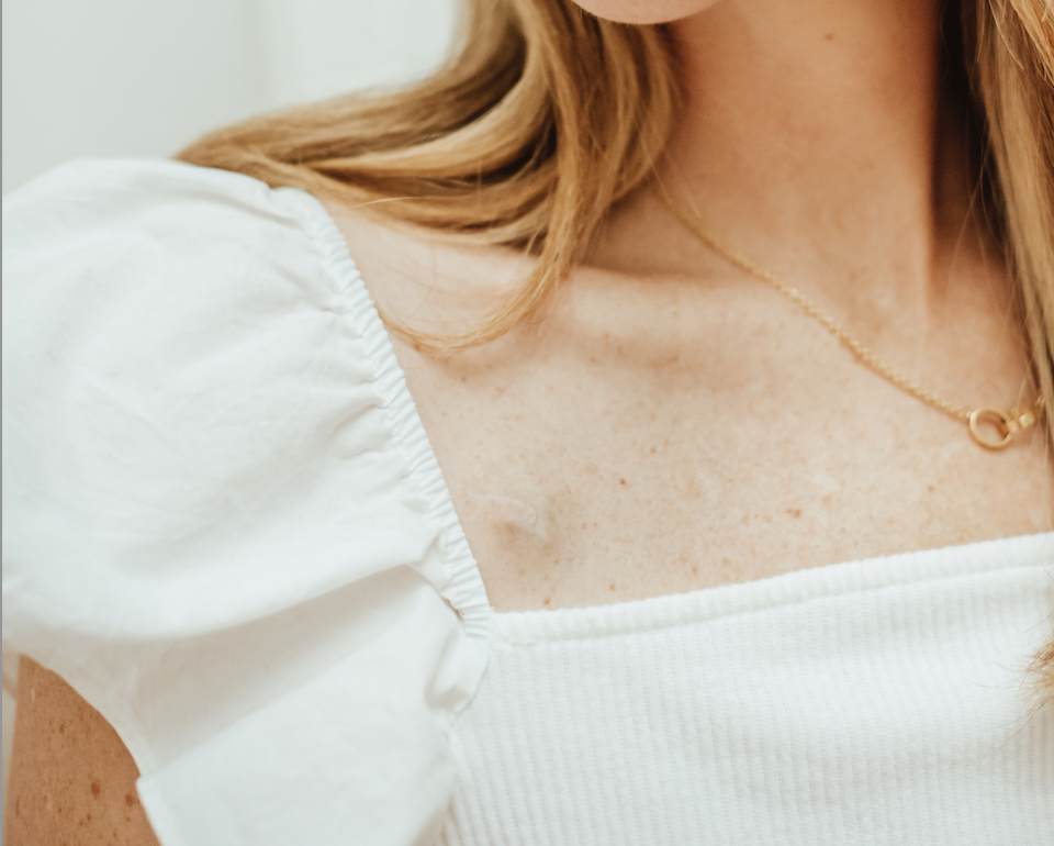 A Port: Tips for Using & Questions to Ask - Cancer Advice