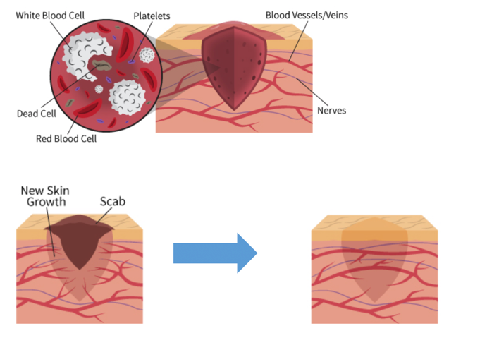 The Light for your Wounds - Kaiyan Medical