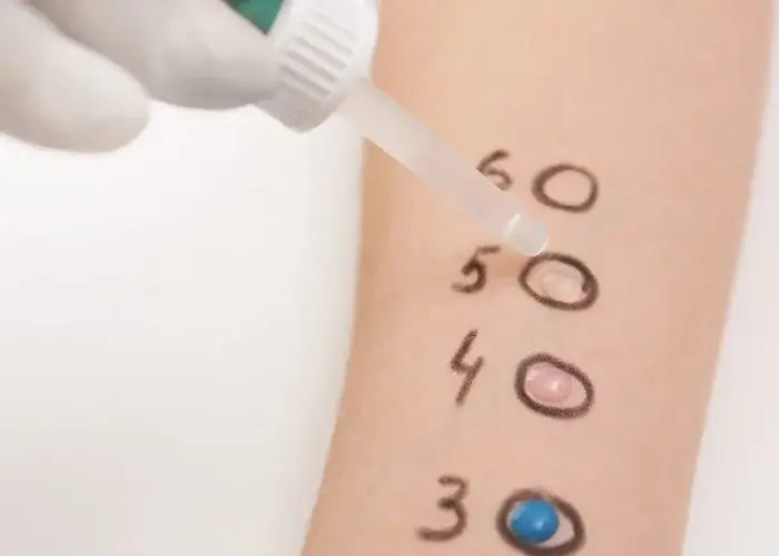 Skin Surveillance | Opus Safety