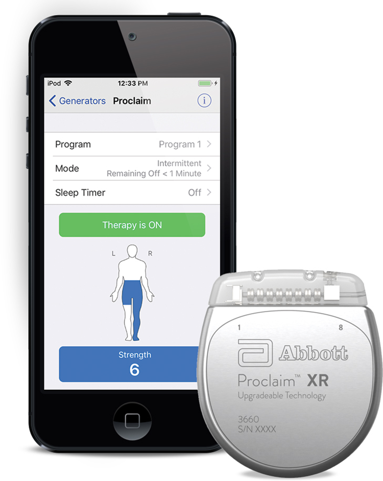 Wearable technologies