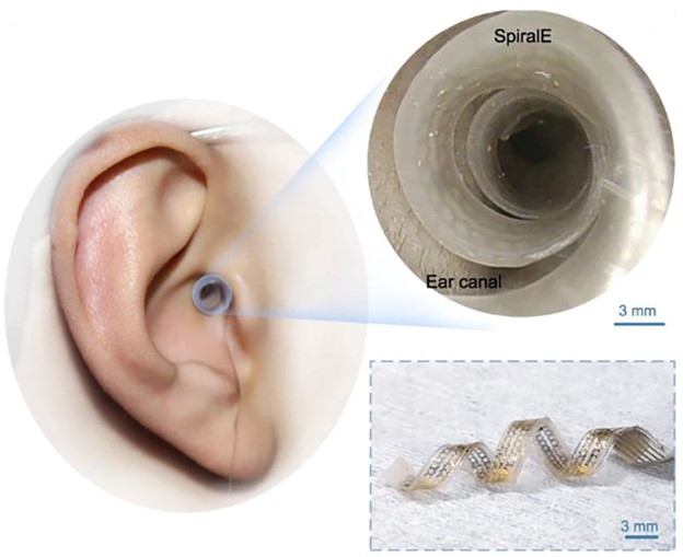 Spiral Wearable Monitors Brain Activity From Inside Ear Canal