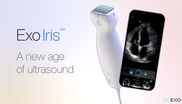Exo Iris: New Handheld AI-Powered Ultrasound System