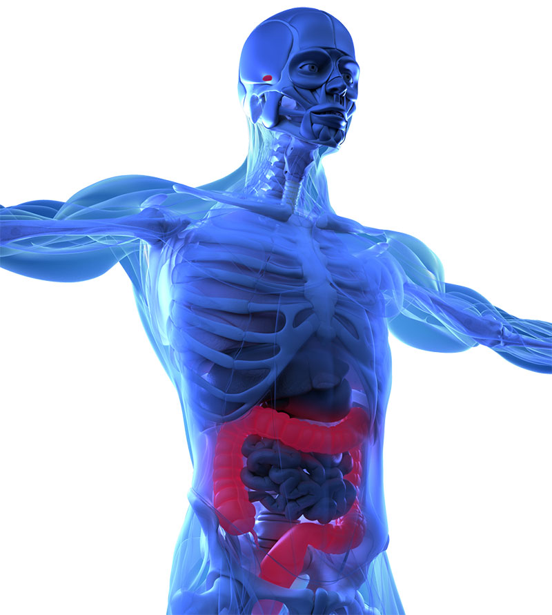 FDA Clears Wearable Device to Treat Irritable Bowel Syndrome