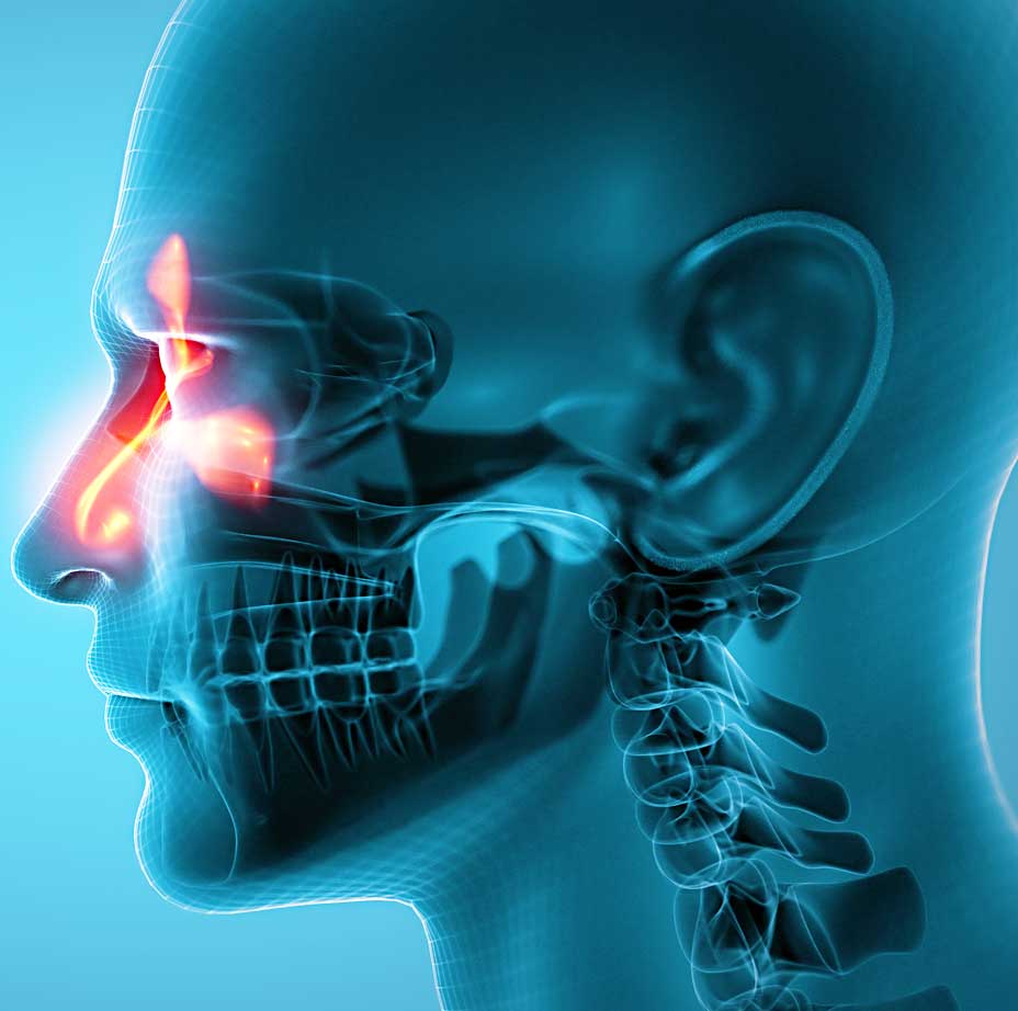 Exhale Sinus, TMJ, Headache & Sleep/J-Flap Procedure