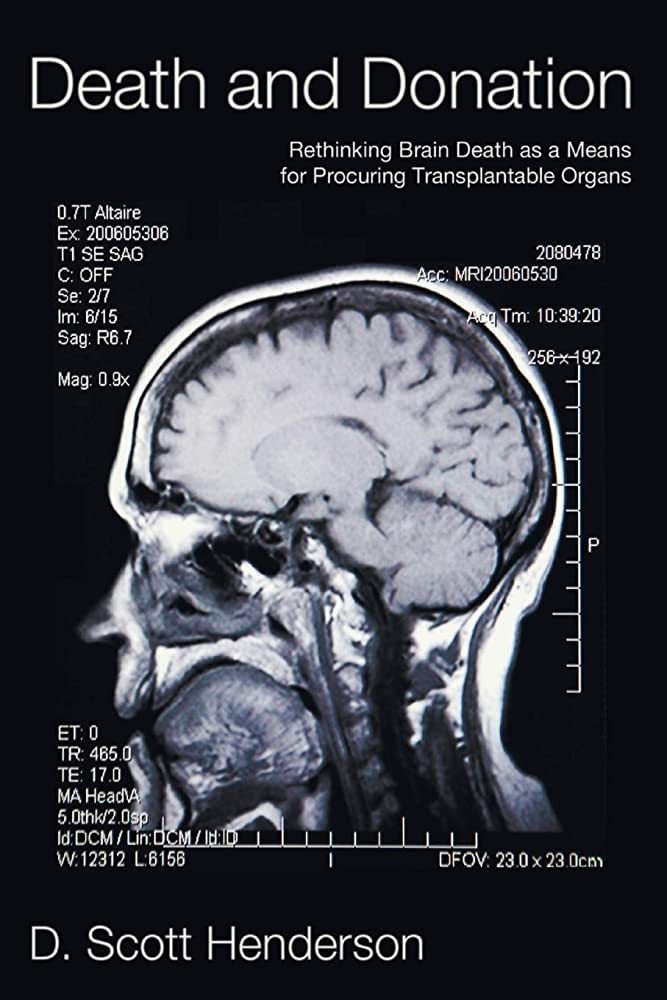 Death and Donation: Rethinking Brain Death as a Means for Procuring ...