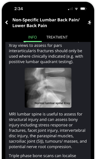 Learn to ease your lower back pain | Fixitdoc