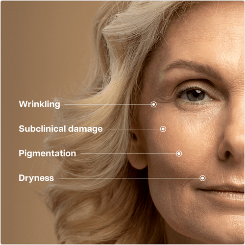 Sun damaged skin: types and treatments