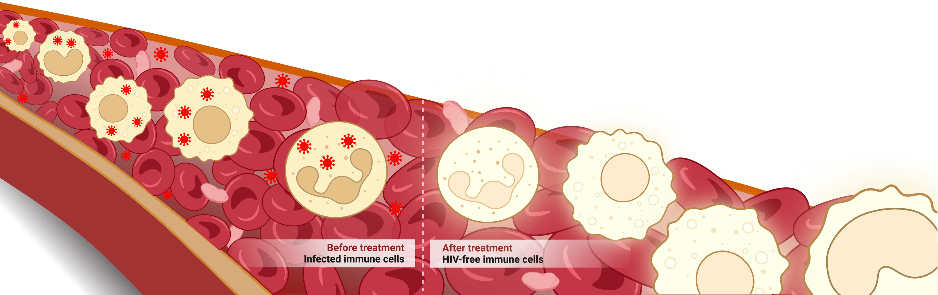 Exploring a Potential Cure for AIDS/HIV - Infographic from BioRender