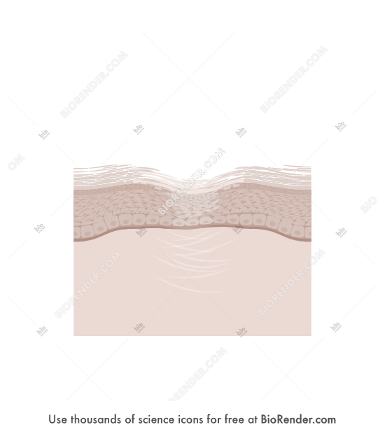 Free Skin (scar) Icons, Symbols & Images | BioRender