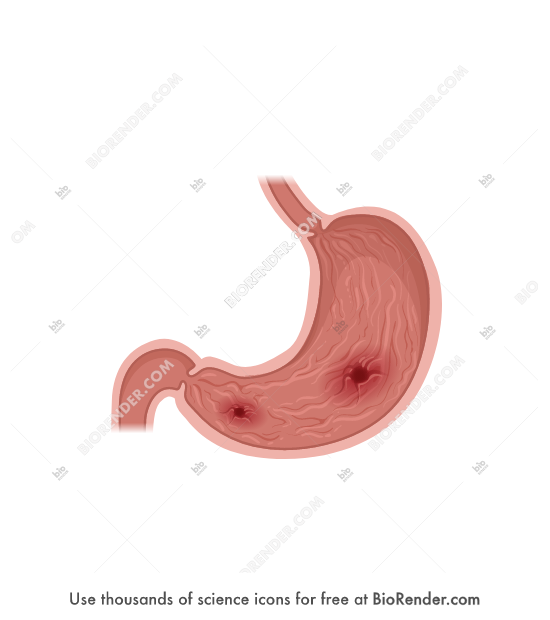Free Stomach (ulcerated) Icons, Symbols & Images | BioRender