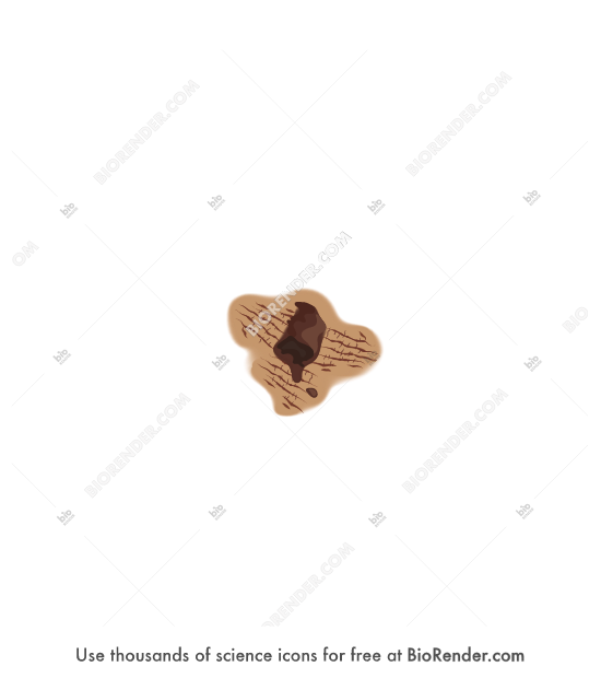 Free Acral lentiginous melanoma (skin cancer) Icons, Symbols & Images ...