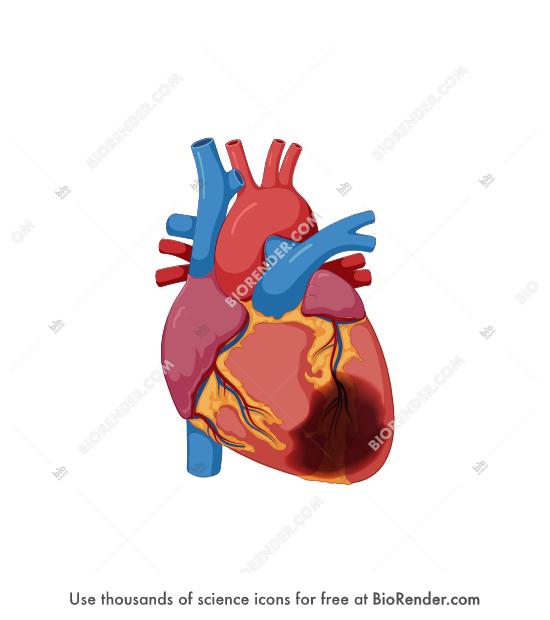 Free Heart Myocardial Infarction Icons Symbols And Images Biorender