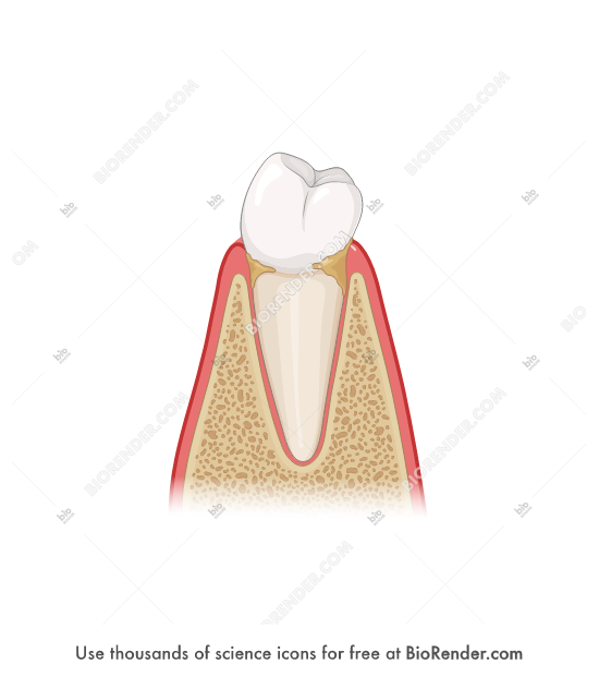 Free Tooth (premolar, gingivitis) Icons, Symbols & Images | BioRender