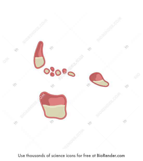 Free Paranasal sinuses (lateral view, inflamed) Icons, Symbols & Images ...