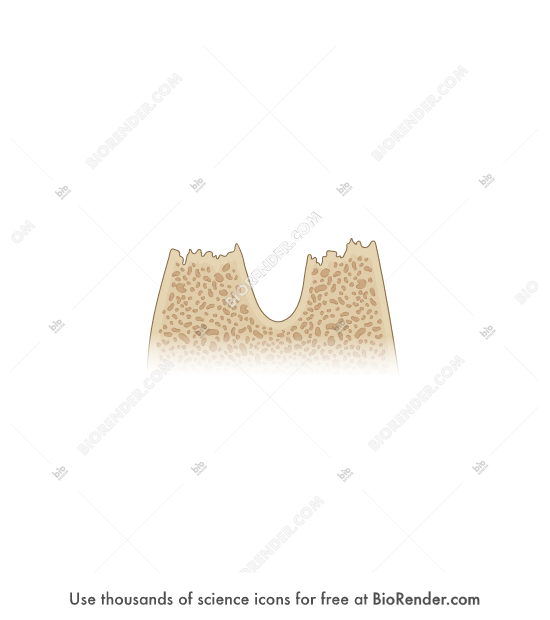 Free Tooth (premolar, bone, severe bone loss) Icons, Symbols & Images ...