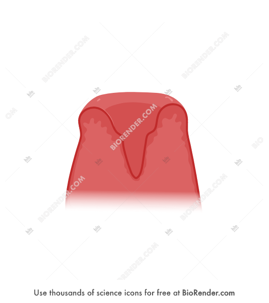 Free Tooth (premolar, gums, severe periodontal disease) Icons, Symbols ...