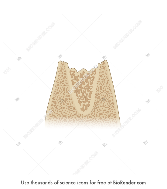 Free Tooth (premolar, bone, bone loss, woven) Icons, Symbols & Images ...