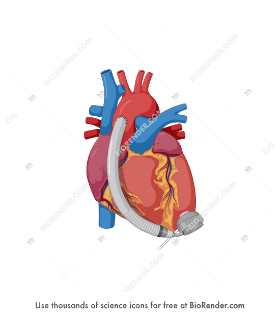 Free Heart (left ventricular assist device) Icons, Symbols & Images ...