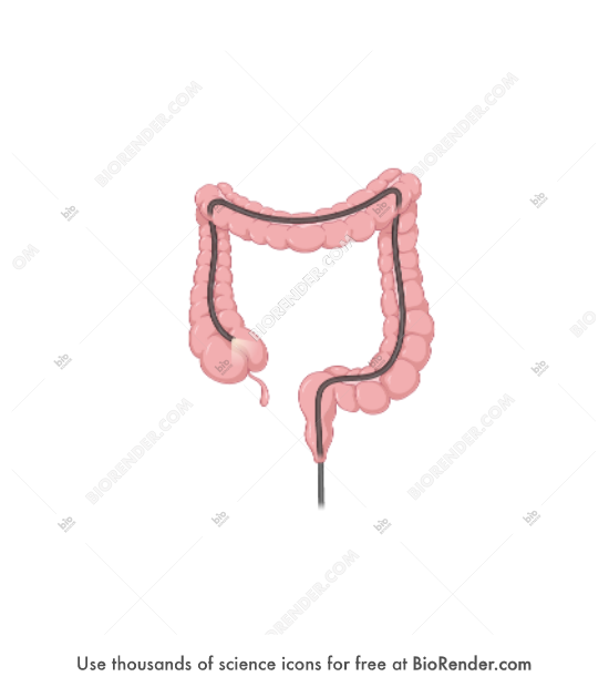 Free Large intestine (colonoscopy) Icons, Symbols & Images | BioRender