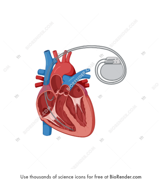 Free Heart (cross-section, pacemaker) Icons, Symbols & Images | BioRender
