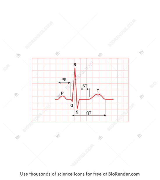 Free ECG tracing (normal, labelled) Icons, Symbols & Images | BioRender