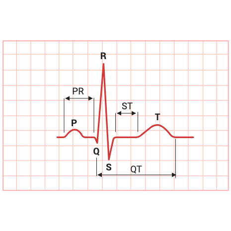 Free ECG tracing (normal, labelled) Icons, Symbols & Images | BioRender