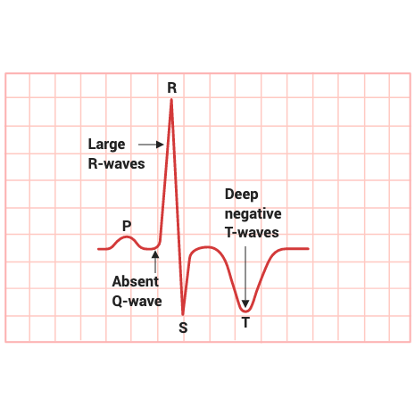 Free Graph Icons Icons, Symbols & Images | BioRender