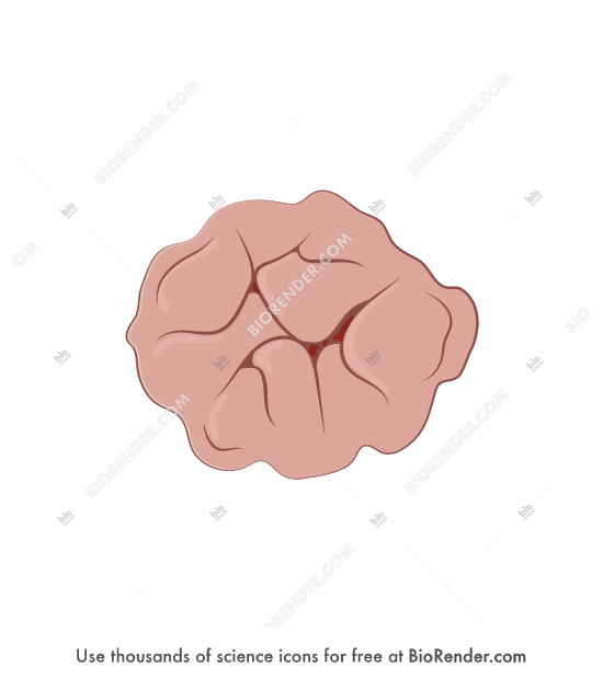 Free Tumor (round, cross-section) Icons, Symbols & Images | BioRender