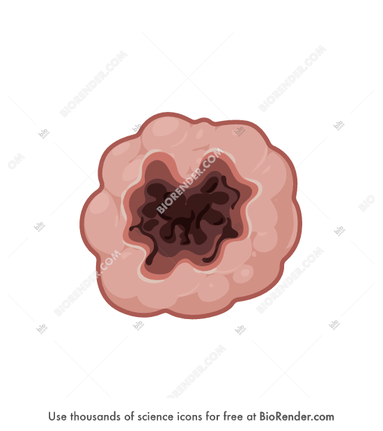 Free Tumor (round, necrosis 1) Icons, Symbols & Images | BioRender