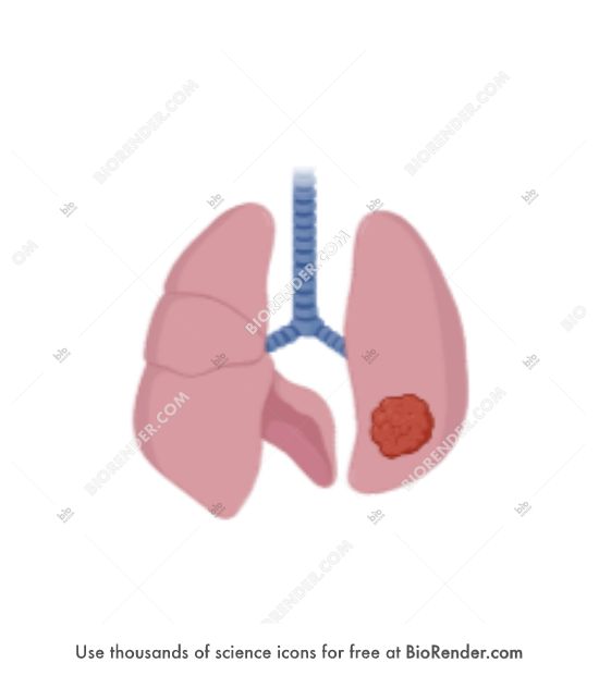 Free Mouse lung (with tumor) Icons, Symbols & Images | BioRender