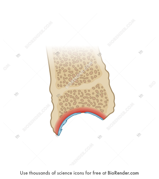 Free Mouse tibia (distal end, sagittal cut, arthritic) Icons, Symbols ...