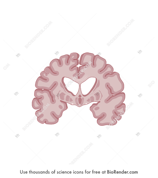 Free Brain (coronal cut, at basal ganglia, Huntington's disease) Icons ...