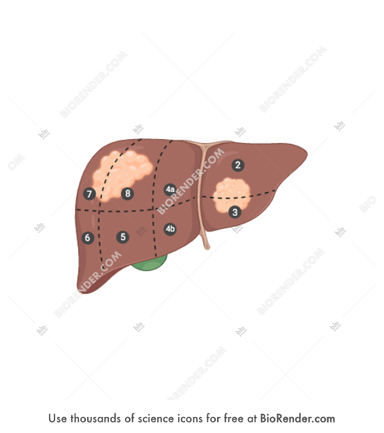 Free Liver (hepatic sections and cancerous tumors) Icons, Symbols ...