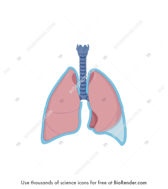Free Lungs (pleural effusion) Icons, Symbols & Images | BioRender