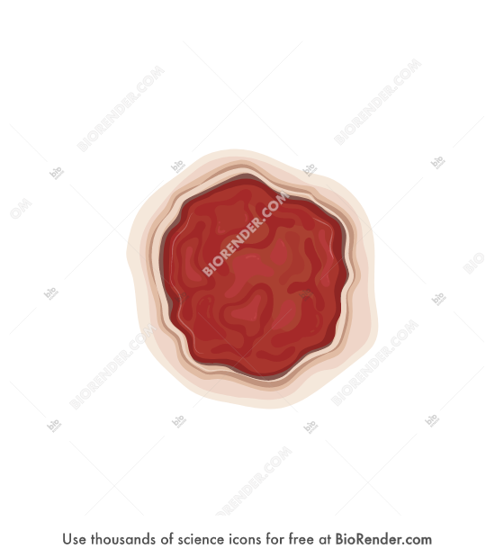 Free Wound (chronic) Icons, Symbols & Images | BioRender