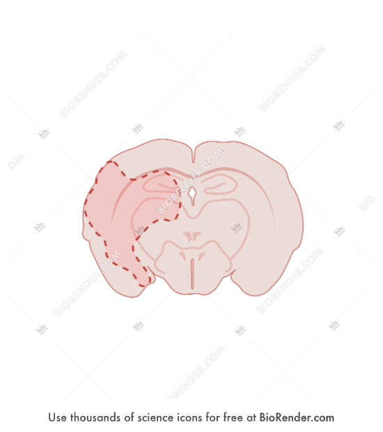Free Mouse coronal brain (with stroke) Icons, Symbols & Images | BioRender